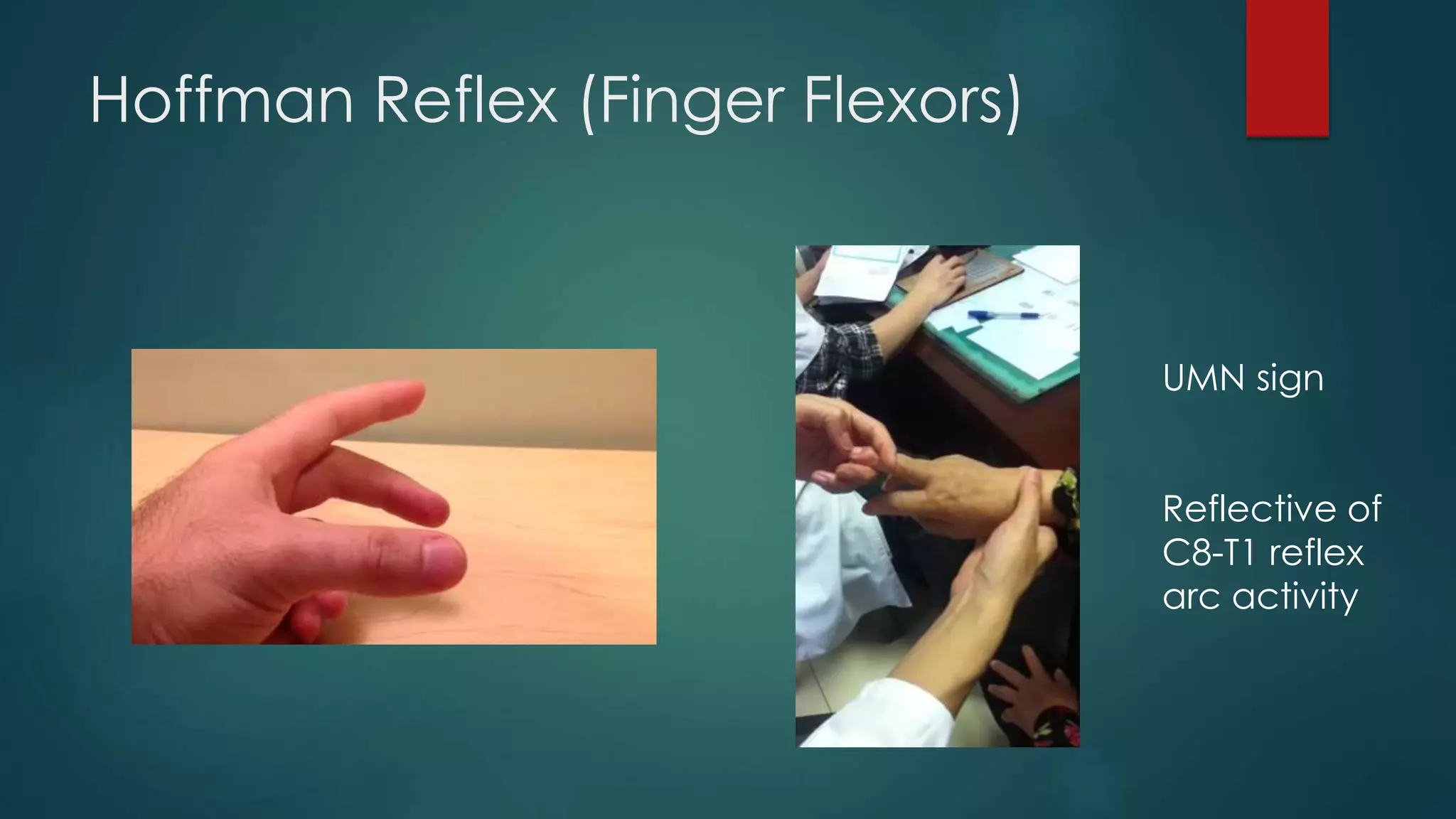 Forgotten Reflex Testing | PPTX