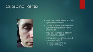 Forgotten Reflex Testing | PPTX