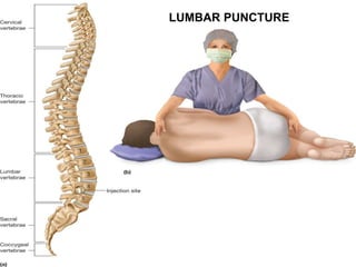 Lumbar puncture Safety tool | PPTX | Physics | Science