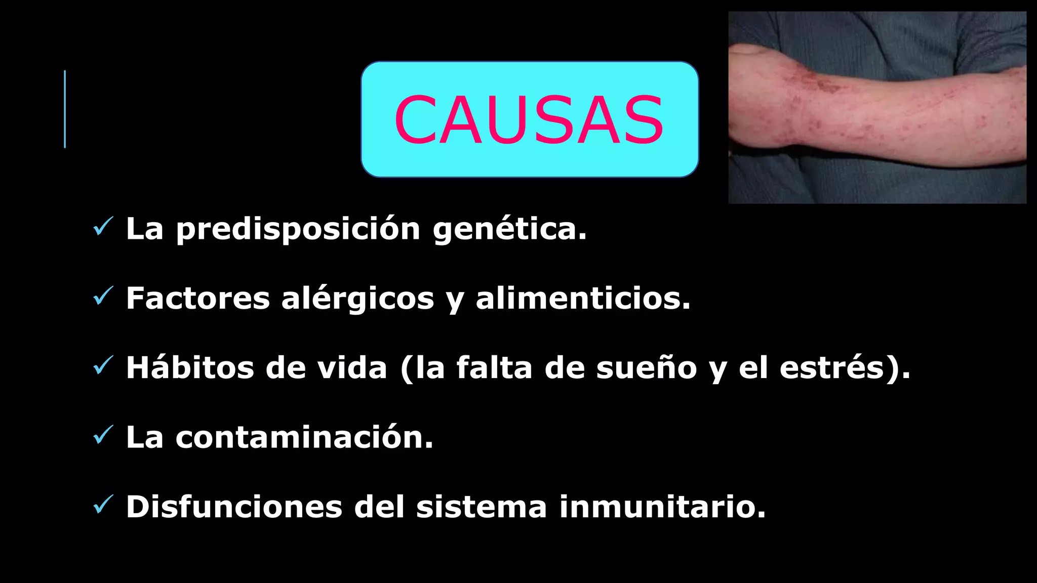Dermatitis Atópica Crónica | PPTX