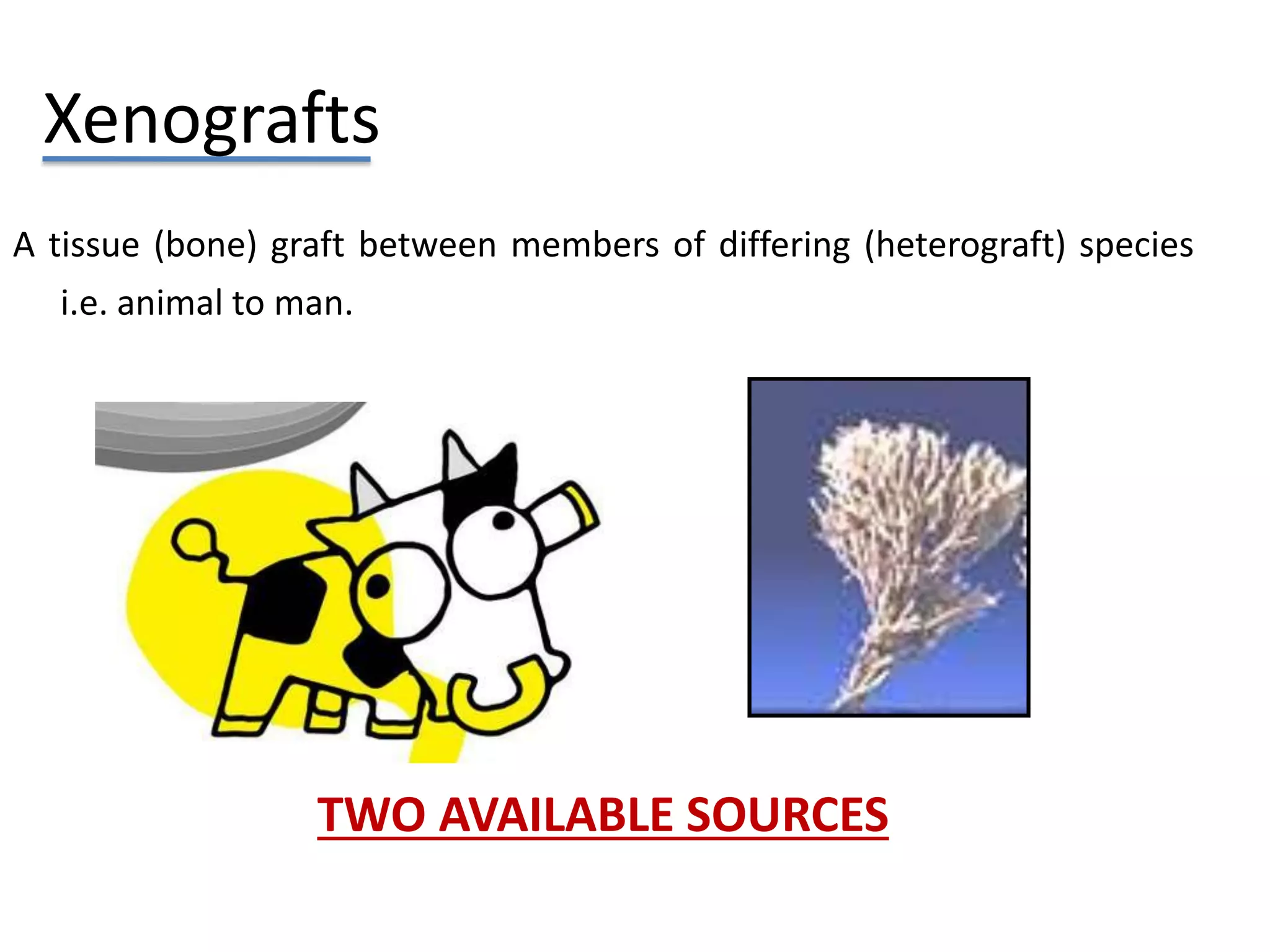Bone Grafts | PDF