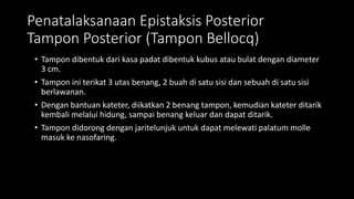 Epistaksis posterior | PPTX