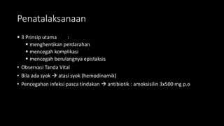 Epistaksis posterior | PPTX