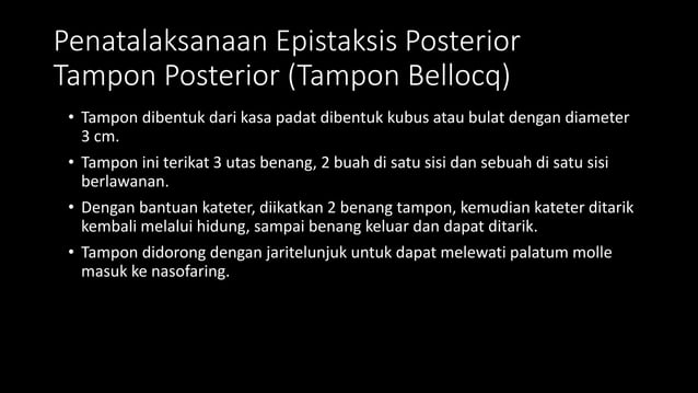Epistaksis posterior | PPTX