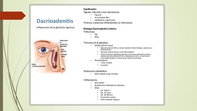 Dacroadenitis