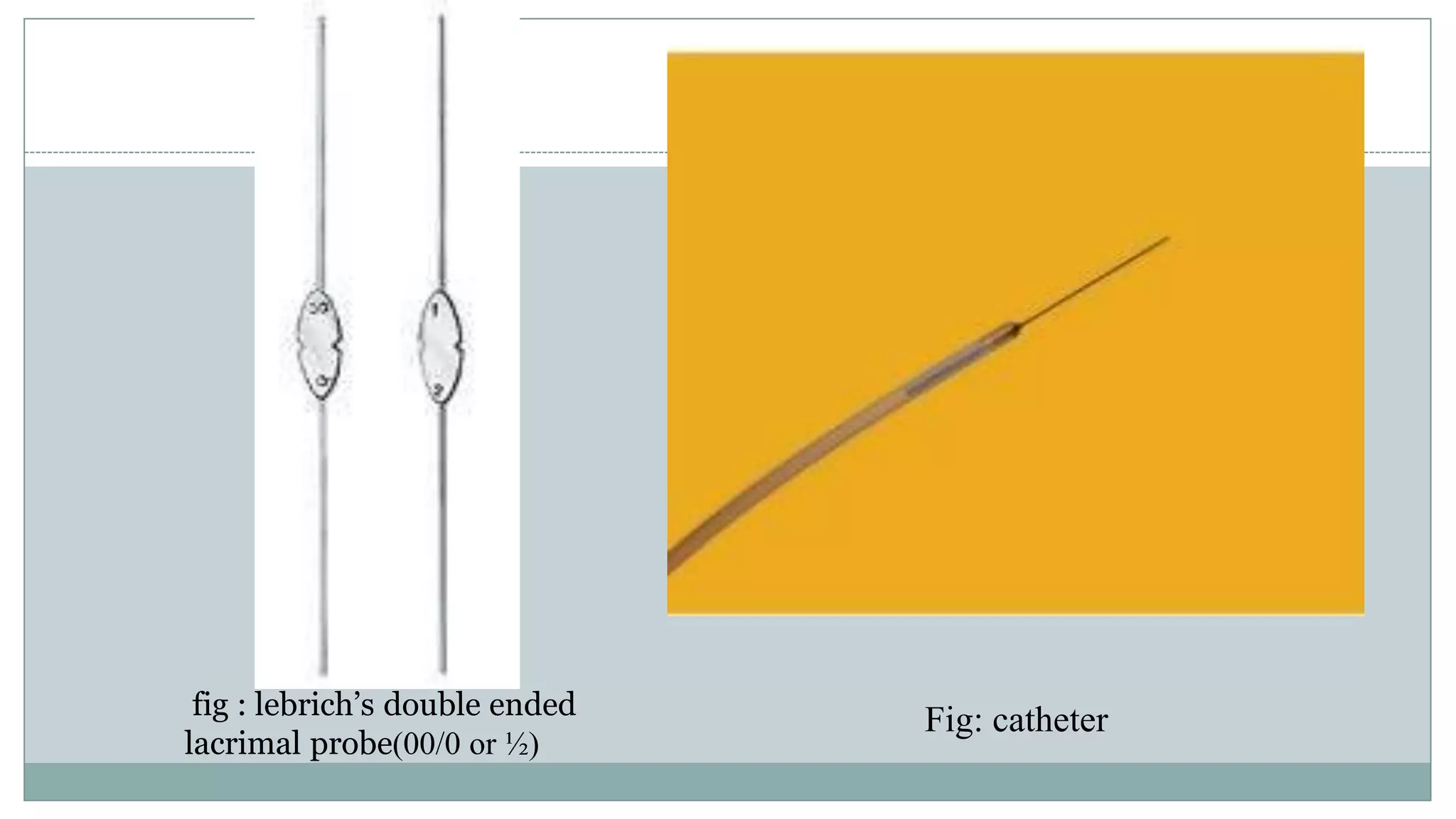 Dacrocysstography and Sailography | PPTX