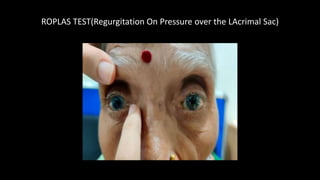 DACROCYSTITIS.pptx