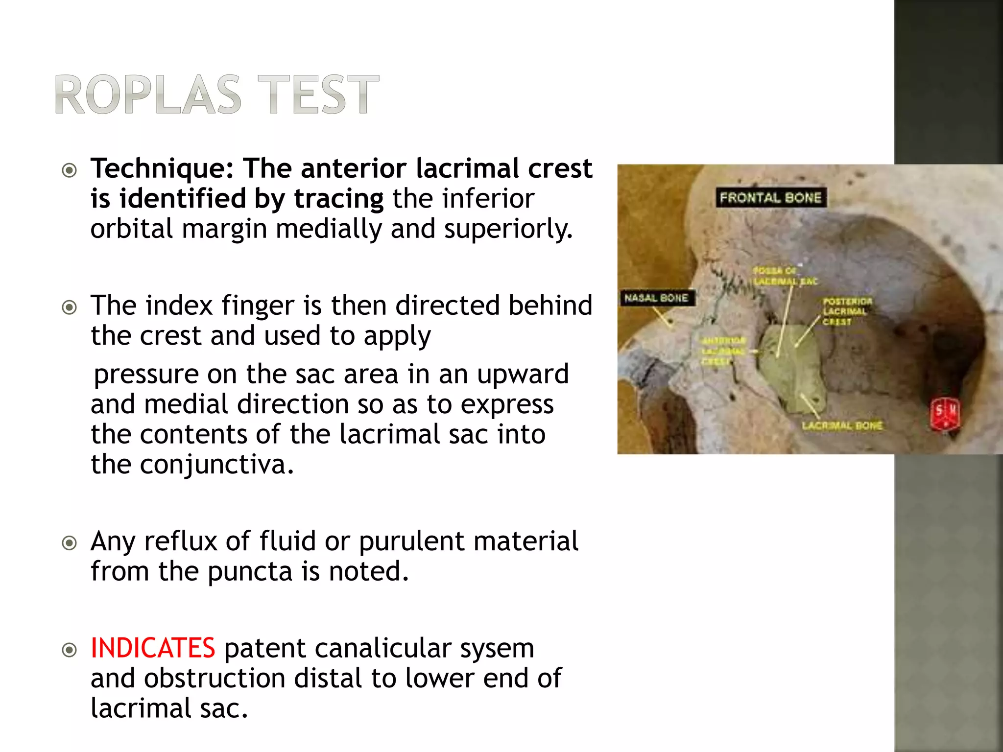 CHRONIC DACROCYSTITIS AND ITS MANAGEMENT | PPTX