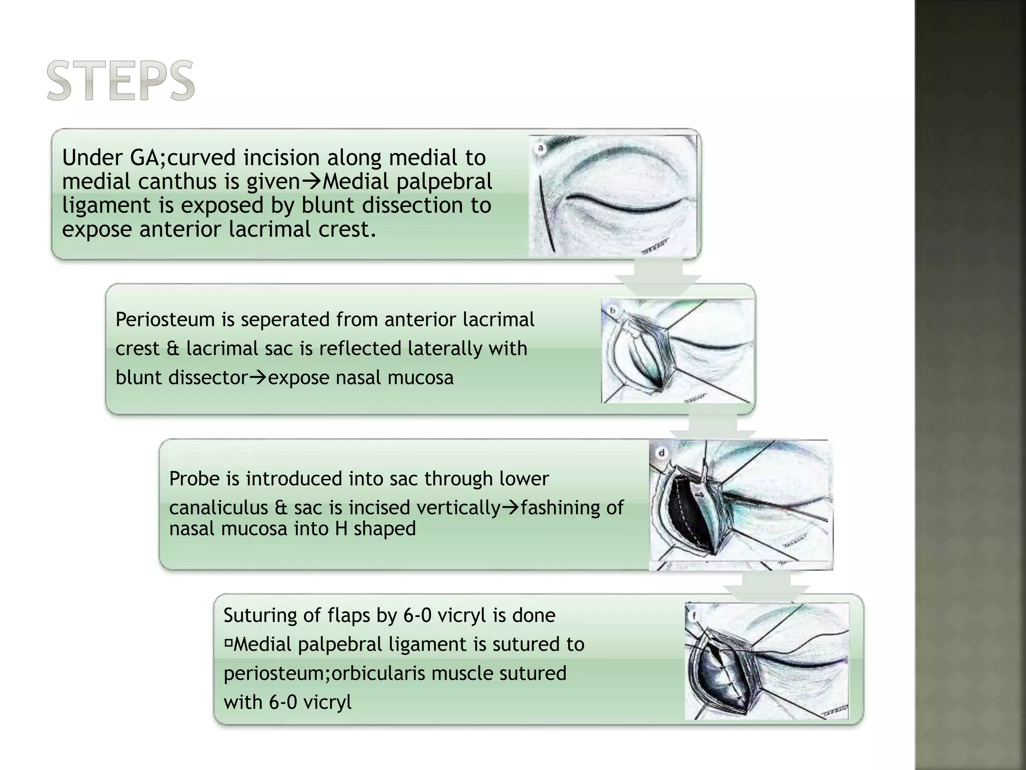 CHRONIC DACROCYSTITIS AND ITS MANAGEMENT | PPTX