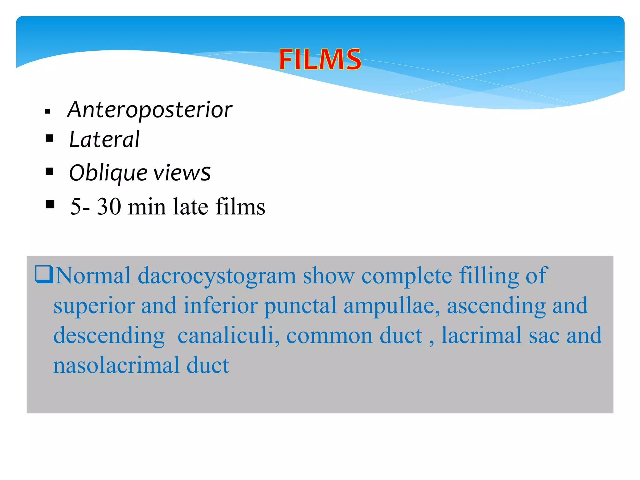 Dacrocystography | PPTX