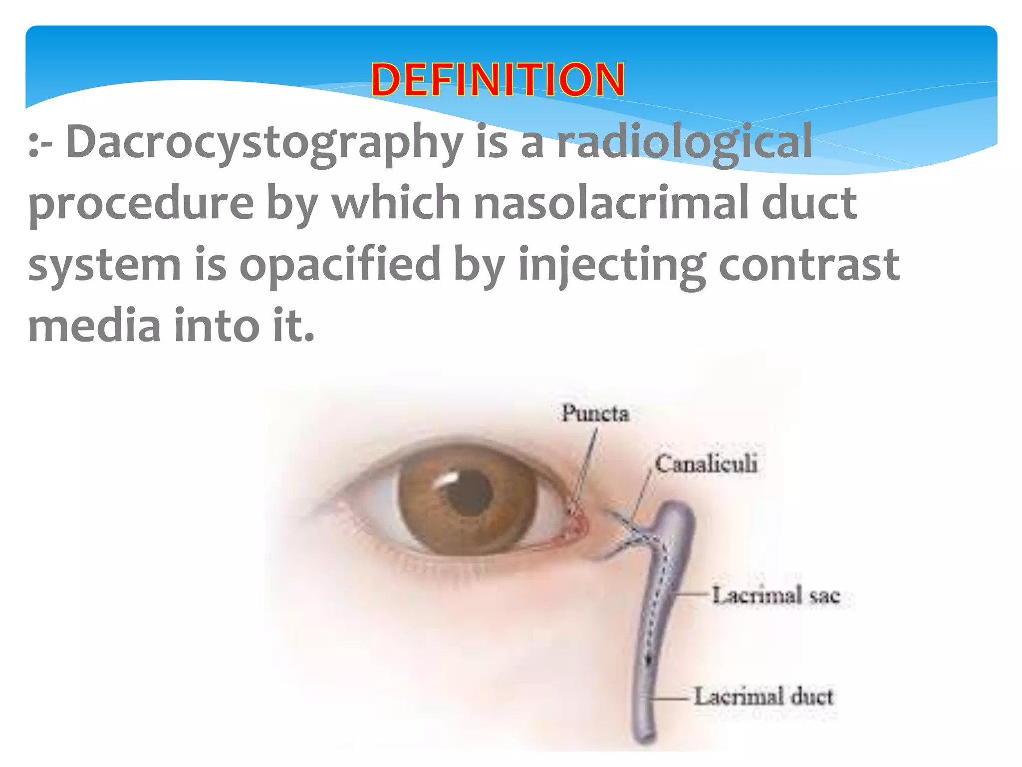 Dacrocystography | PPTX