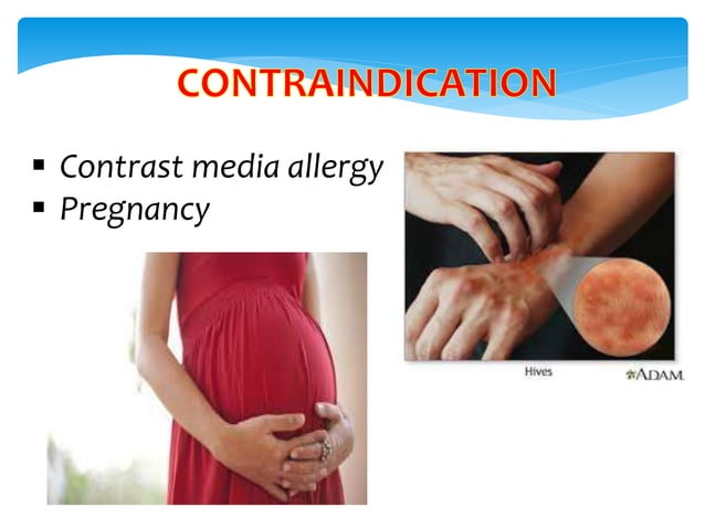 Dacrocystography | PPTX