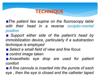 Dacrocystography | PPTX