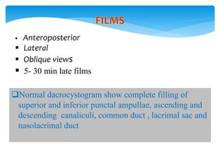 Dacrocystography | PPTX