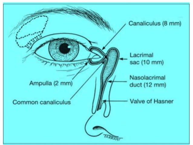Dacrocystography | PPTX