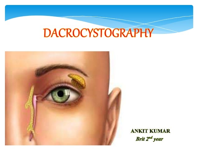 Dacrocystography