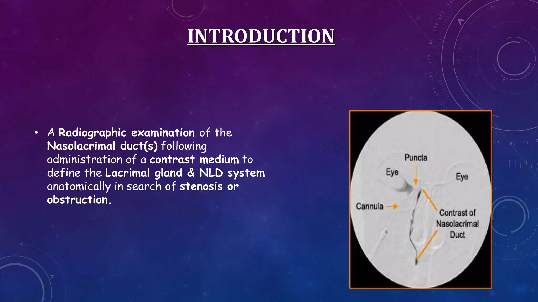 Dacrocystography.pptx