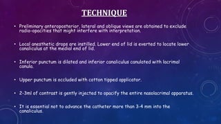 Dacrocystography.pptx