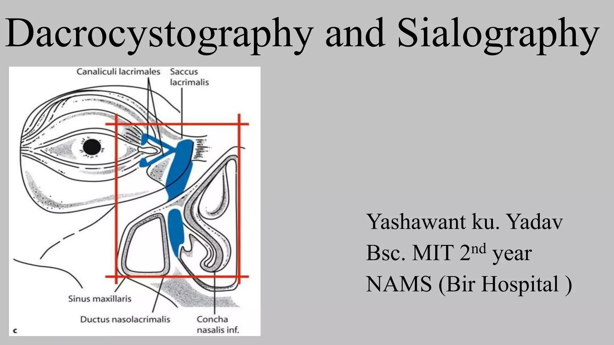 Dacrocystography and sialography | PPTX