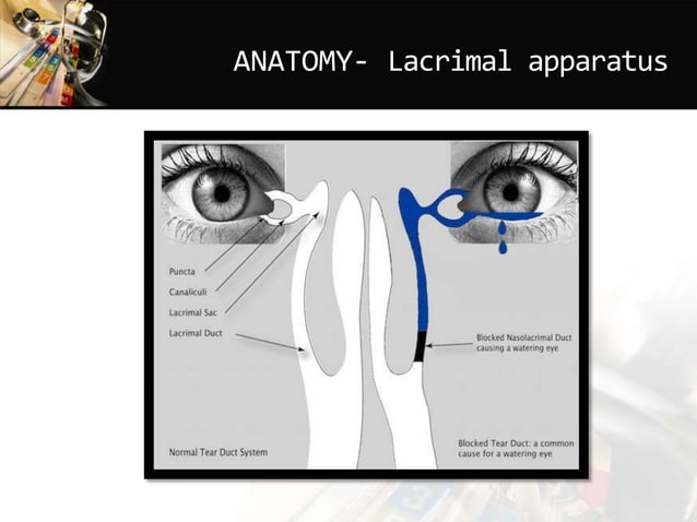 Dacryocystitis | PPTX | Ear, Nose and Throat Conditions | Diseases and ...
