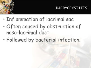 Dacryocystitis