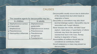 Dacryocystitis | PPTX