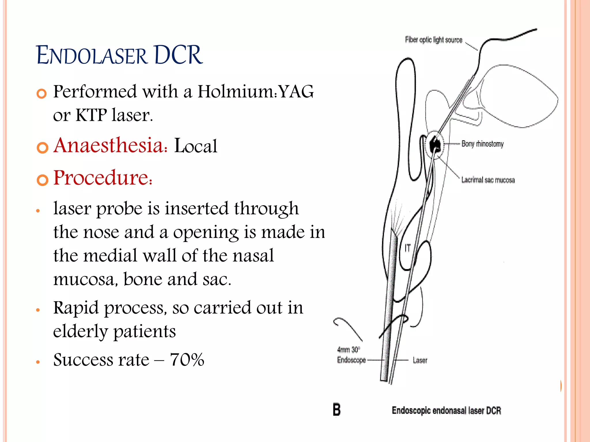 Dacryocystorhinostomy | PPTX