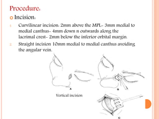 Dacryocystorhinostomy | PPTX