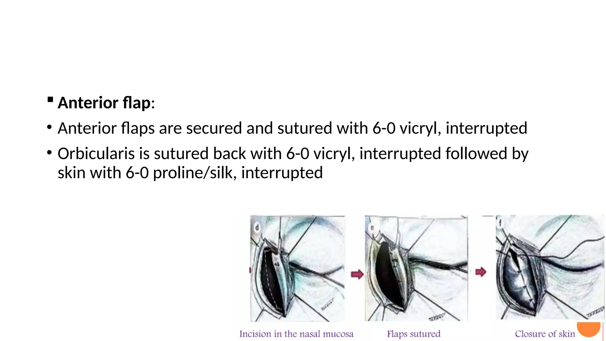 Dacryocystorhinostomy (DCR) presentation.pptx