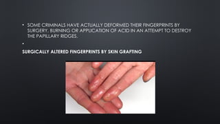 Dactylography is the study of fingerprints in human | PPTX
