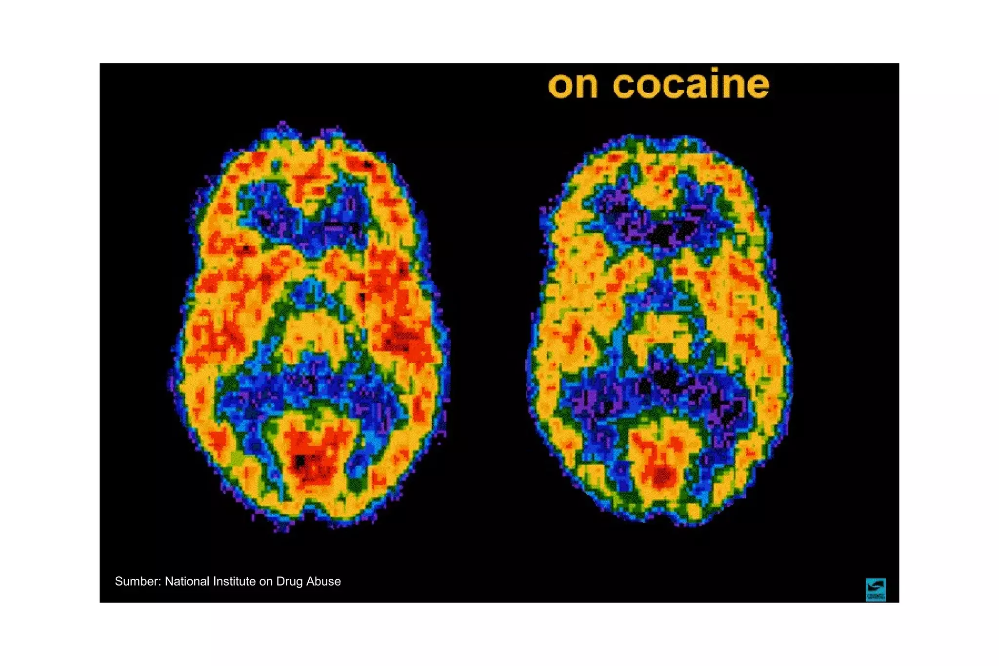 ( Dadah tindakbalas dan kesan inhalan, rokok,alkohol,dadah) | PPT