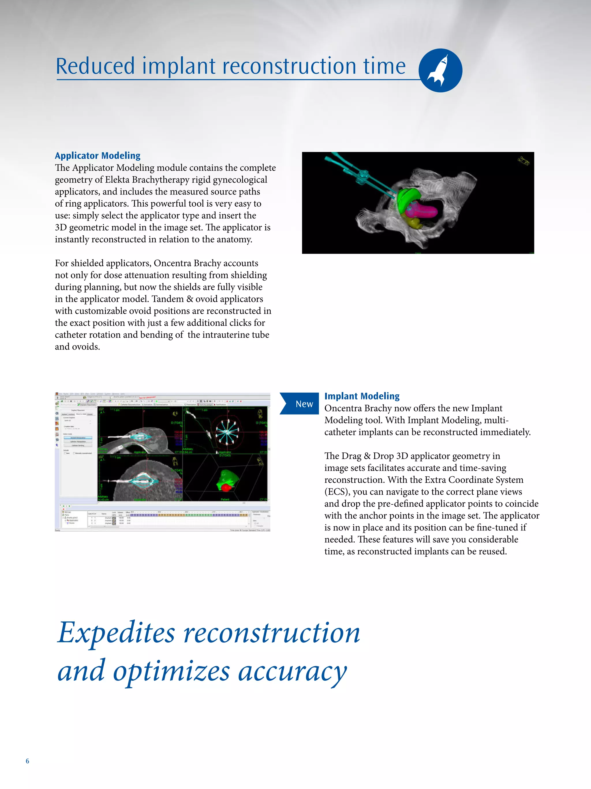 Oncentra® Brachy brochure | PDF
