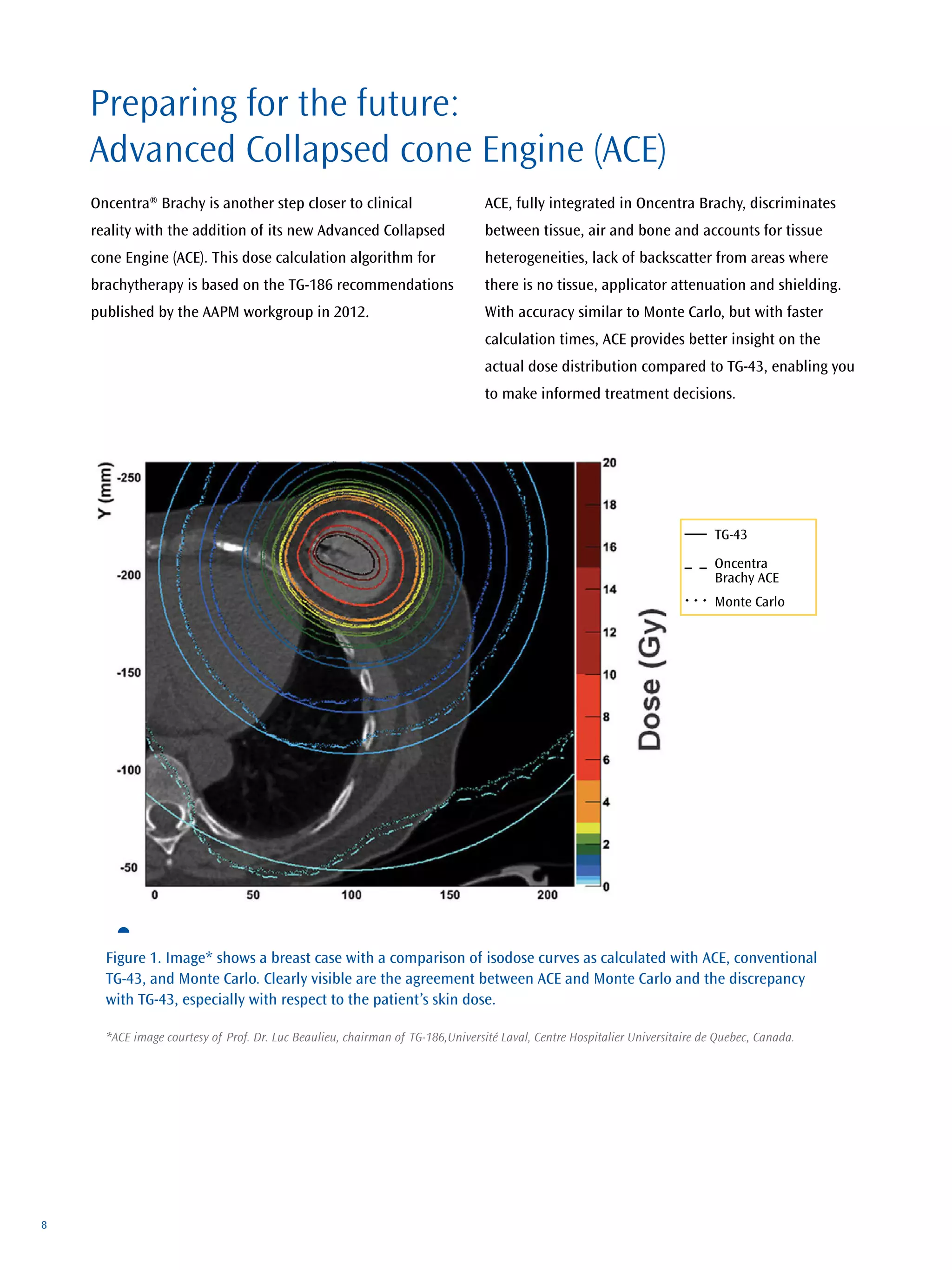 Oncentra® Brachy brochure | PDF
