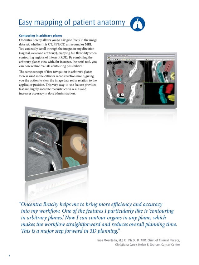 Oncentra® Brachy brochure | PDF
