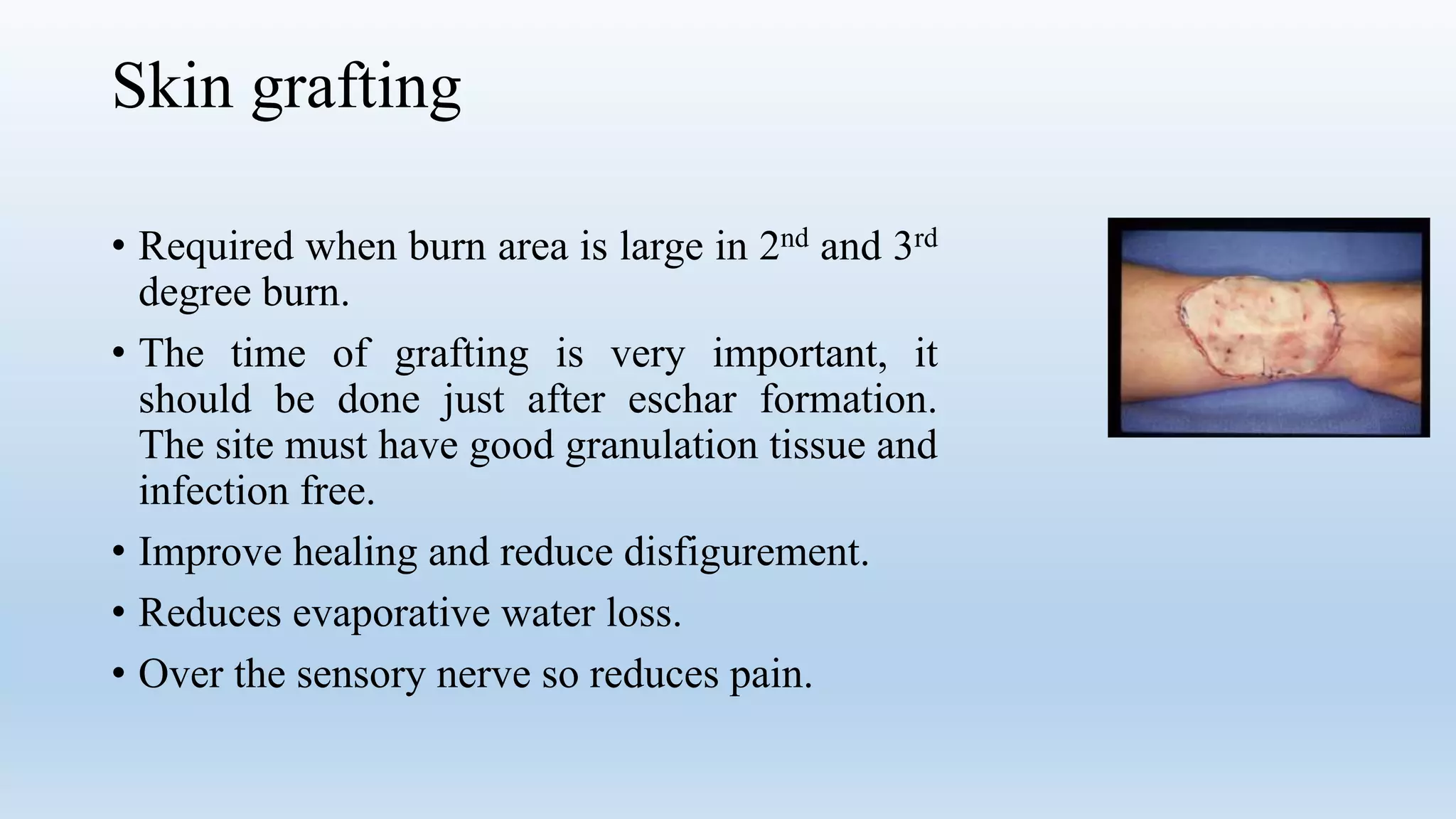 Burn Injury classification and management | PPTX