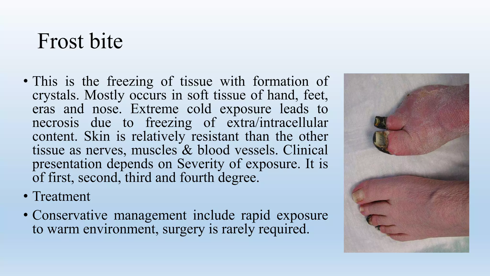 Burn Injury classification and management | PPTX