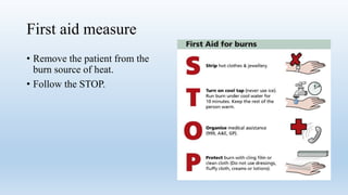 Burn Injury classification and management | PPTX