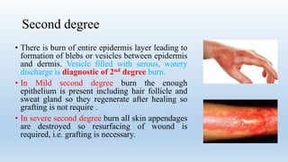 Burn Injury classification and management | PPTX