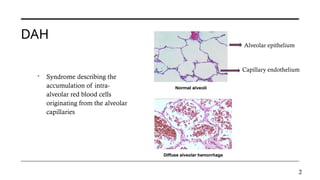 Diffuse Alveolar Hemorrhage and Vasculitis: Pulmonary Renal Syndrome ...