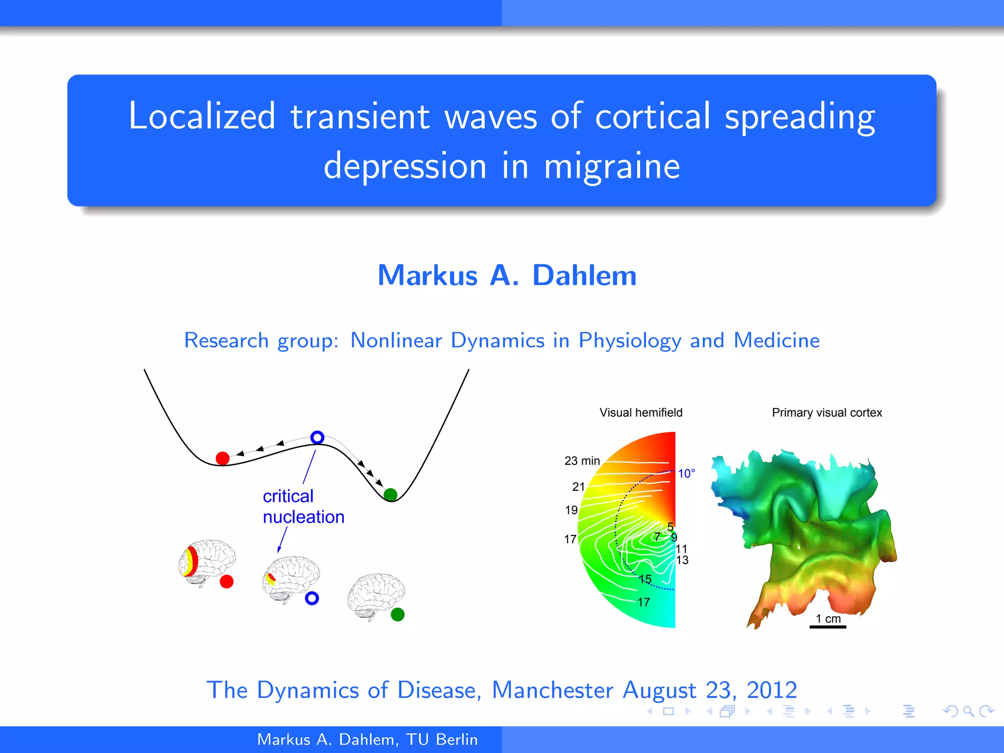 Localized transient waves of cortical spreading depression in migraine ...