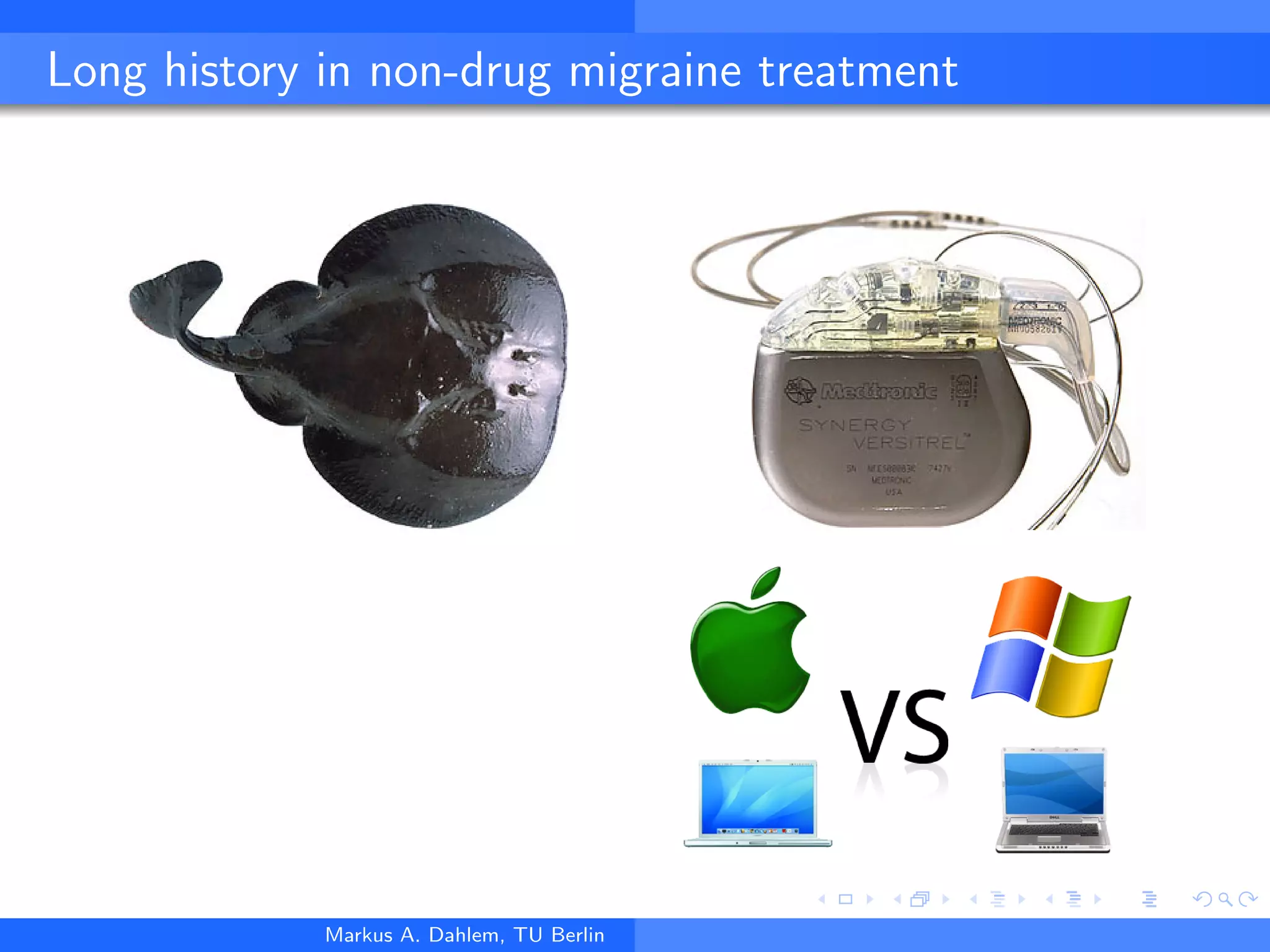 Localized transient waves of cortical spreading depression in migraine ...