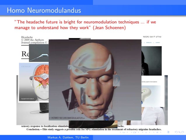 Localized transient waves of cortical spreading depression in migraine | PDF | Brain and Nervous ...