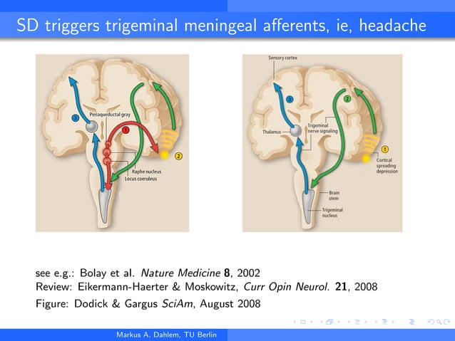 Localized transient waves of cortical spreading depression in migraine | PDF | Brain and Nervous ...