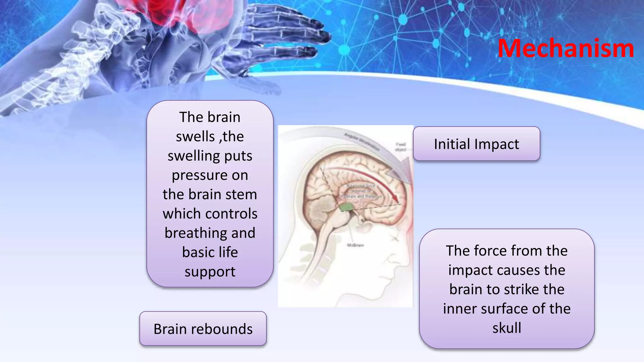 DIFFUSE AXONAL INJURY,CONCUSSION | PPTX