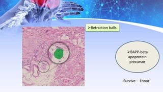 DIFFUSE AXONAL INJURY,CONCUSSION | PPTX