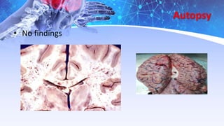 Diffuse Axonal Injury Gross