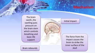 DIFFUSE AXONAL INJURY,CONCUSSION | PPT