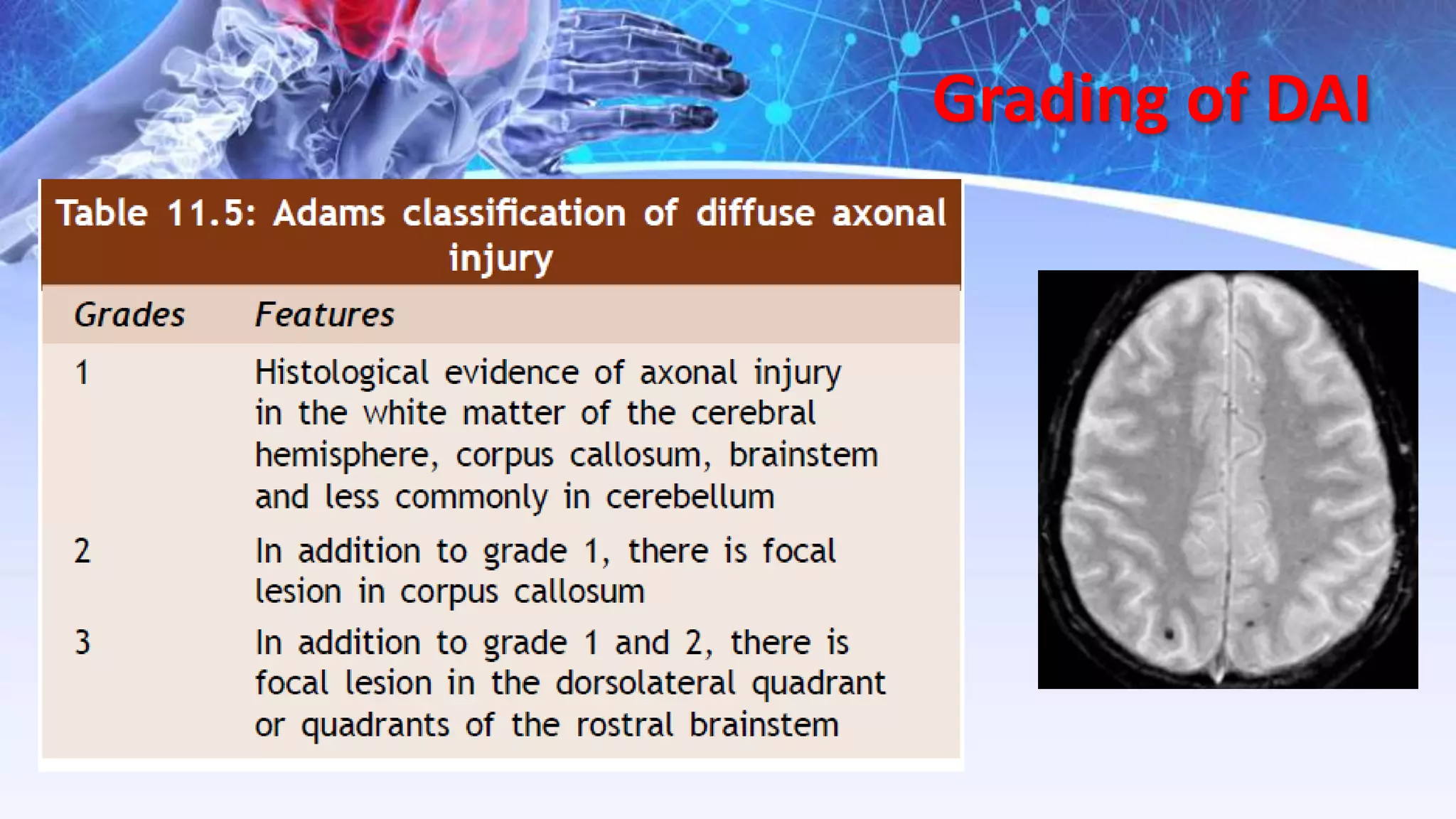 DIFFUSE AXONAL INJURY,CONCUSSION & CONTUSION | PPTX