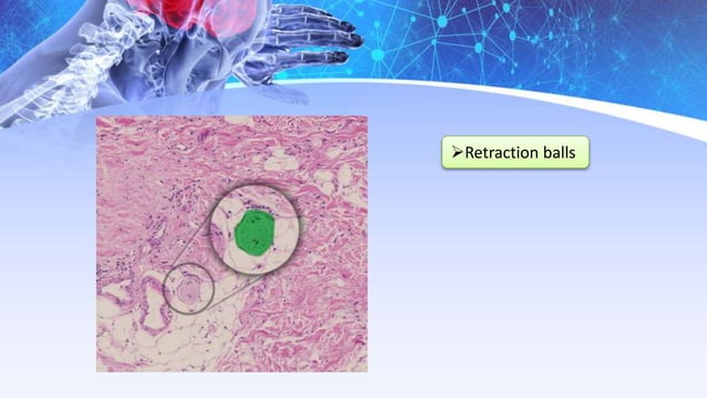 DIFFUSE AXONAL INJURY,CONCUSSION & CONTUSION | PPTX