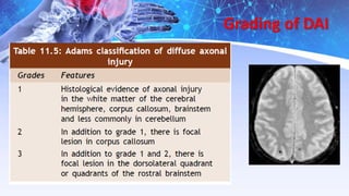 DIFFUSE AXONAL INJURY,CONCUSSION & CONTUSION | PPTX